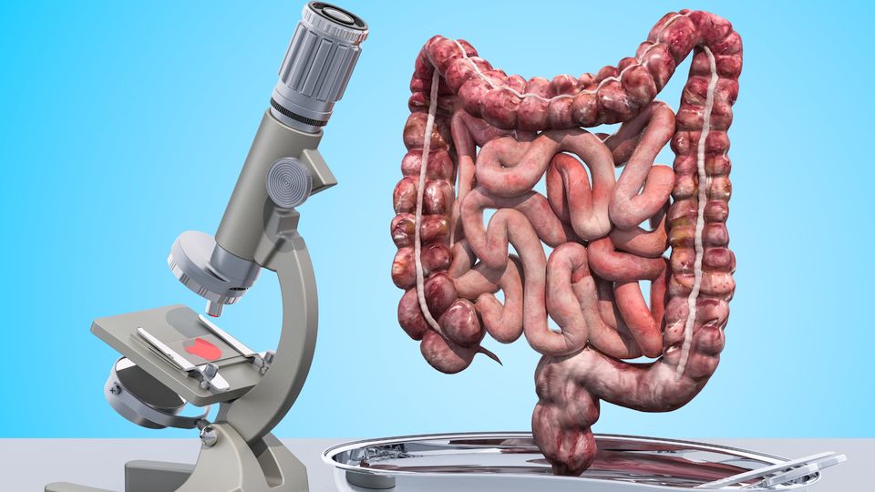 Extra aandacht voor preventie darmkanker in maart | MarketingTribune ...